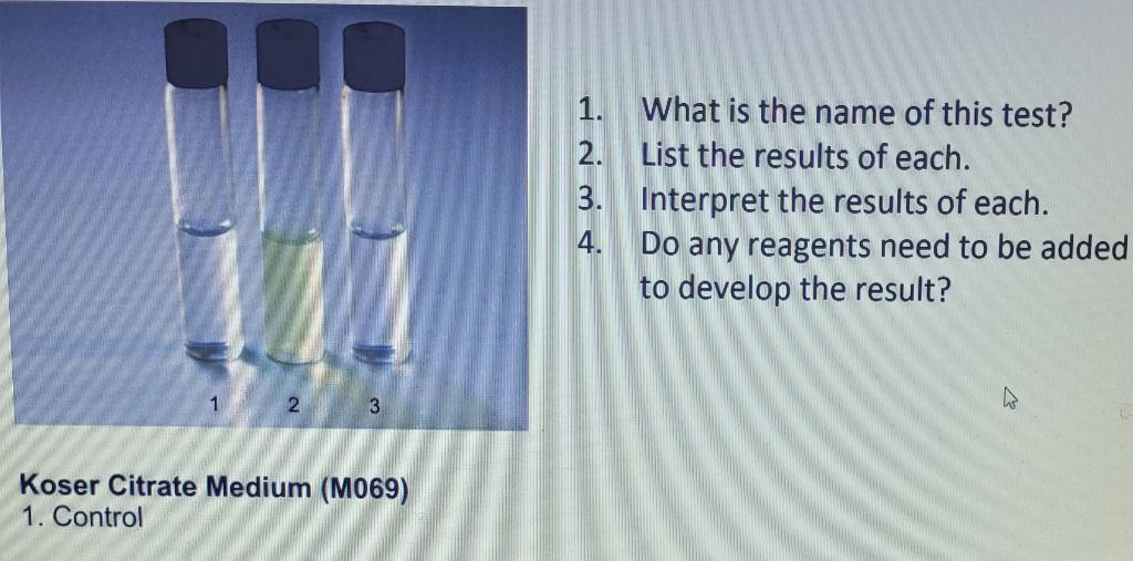 Solved I 1 2 3 Koser Citrate Medium (M069) 1. Control What | Chegg.com