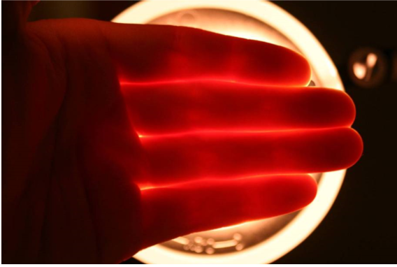 Solved Translucency of hand. Explain the phenomenon in the | Chegg.com