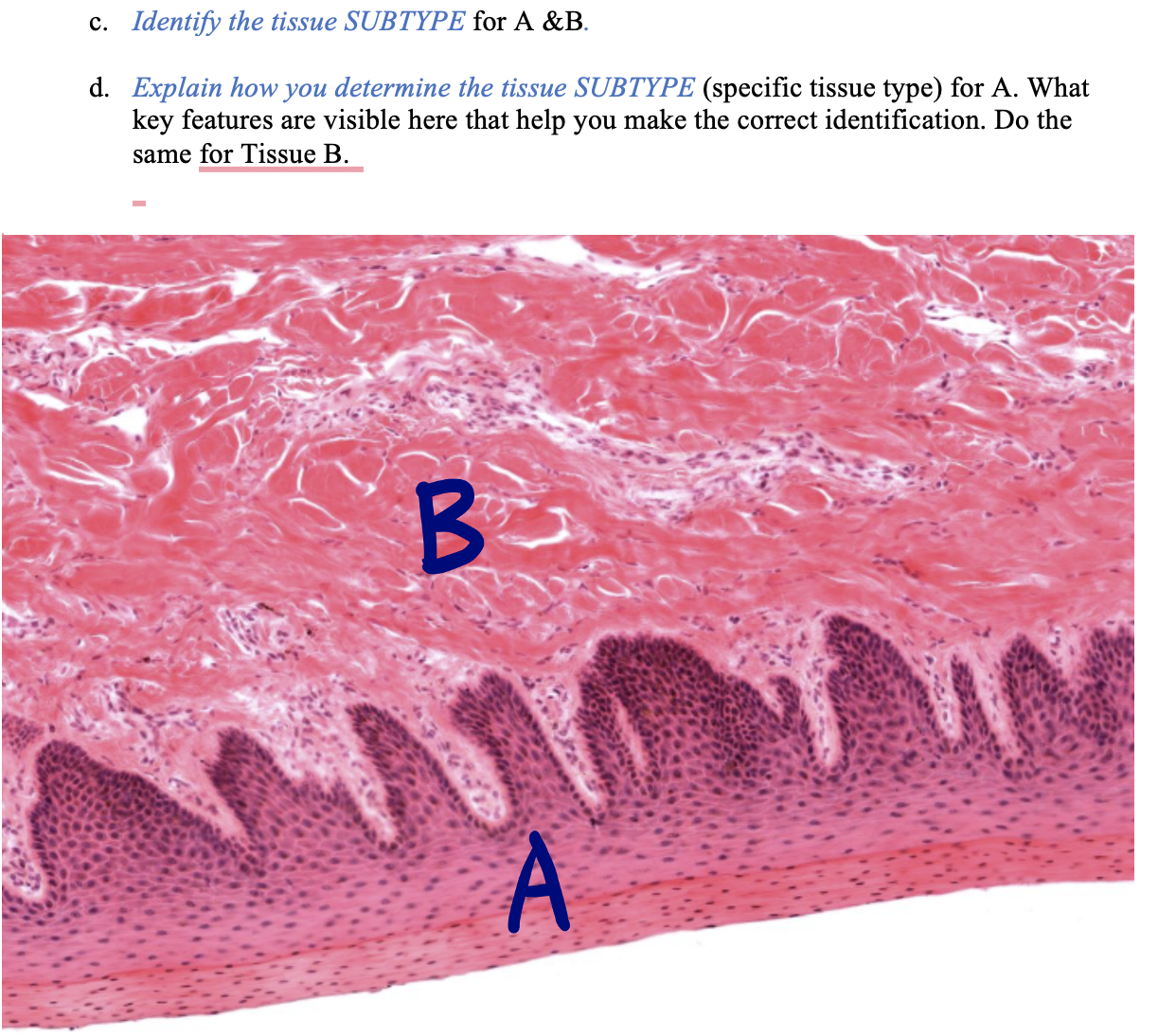 Solved c. ﻿Identify the tissue SUBTYPE for A &B.d. ﻿Explain | Chegg.com
