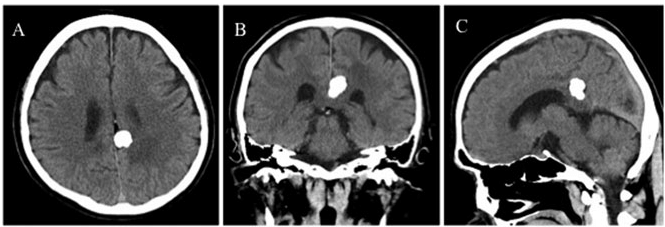 Solved Match the CT Scan below with what PLANE they are | Chegg.com