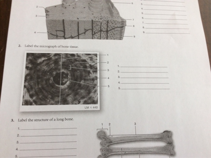 Solved 2. Label the micrograph of bone tissue. 2. 3. 5. LM x | Chegg.com