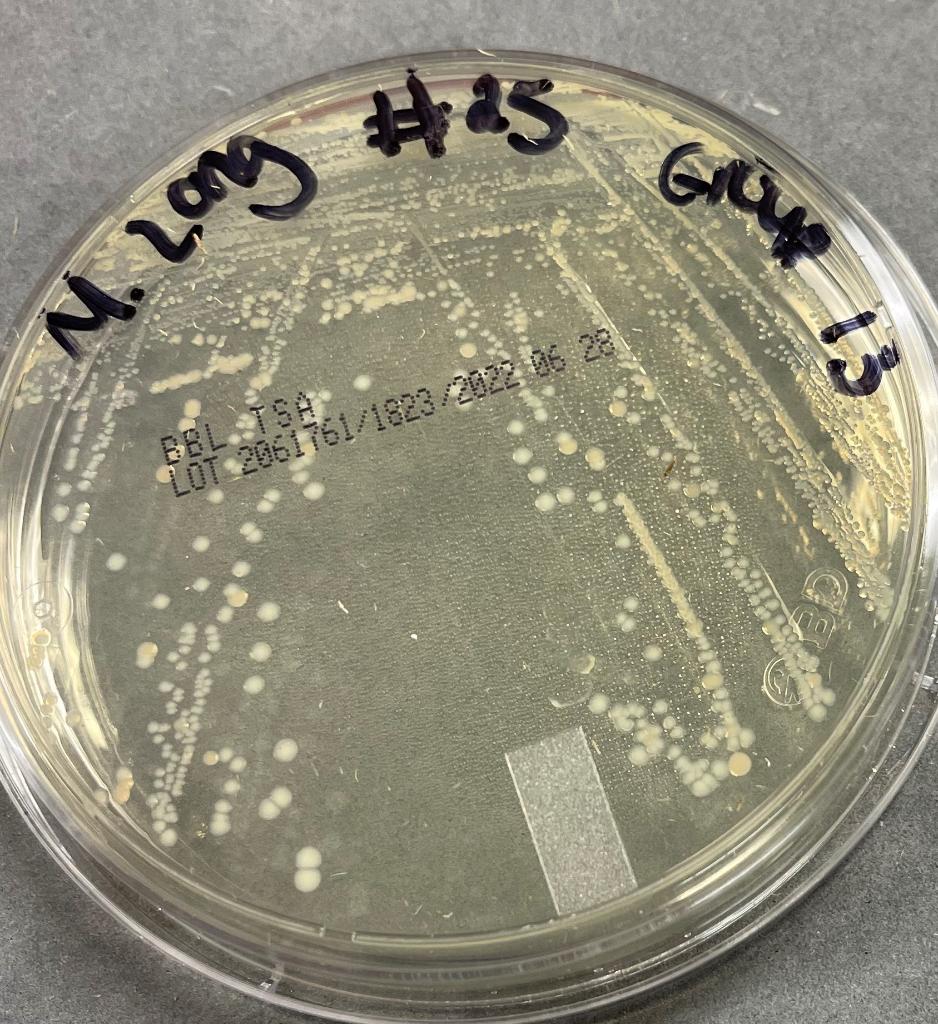 Solved Can anyone help me identify my unknown gram negative | Chegg.com