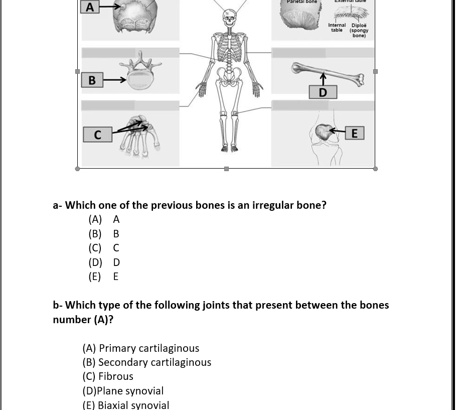 Solved a- ﻿Which one of the previous bones is an irregular | Chegg.com