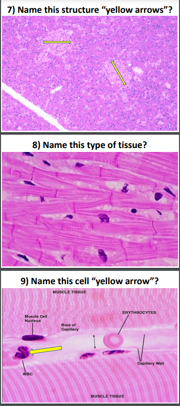 Solved 7) Name this structure "yellow arrows"? 8) Name this | Chegg.com