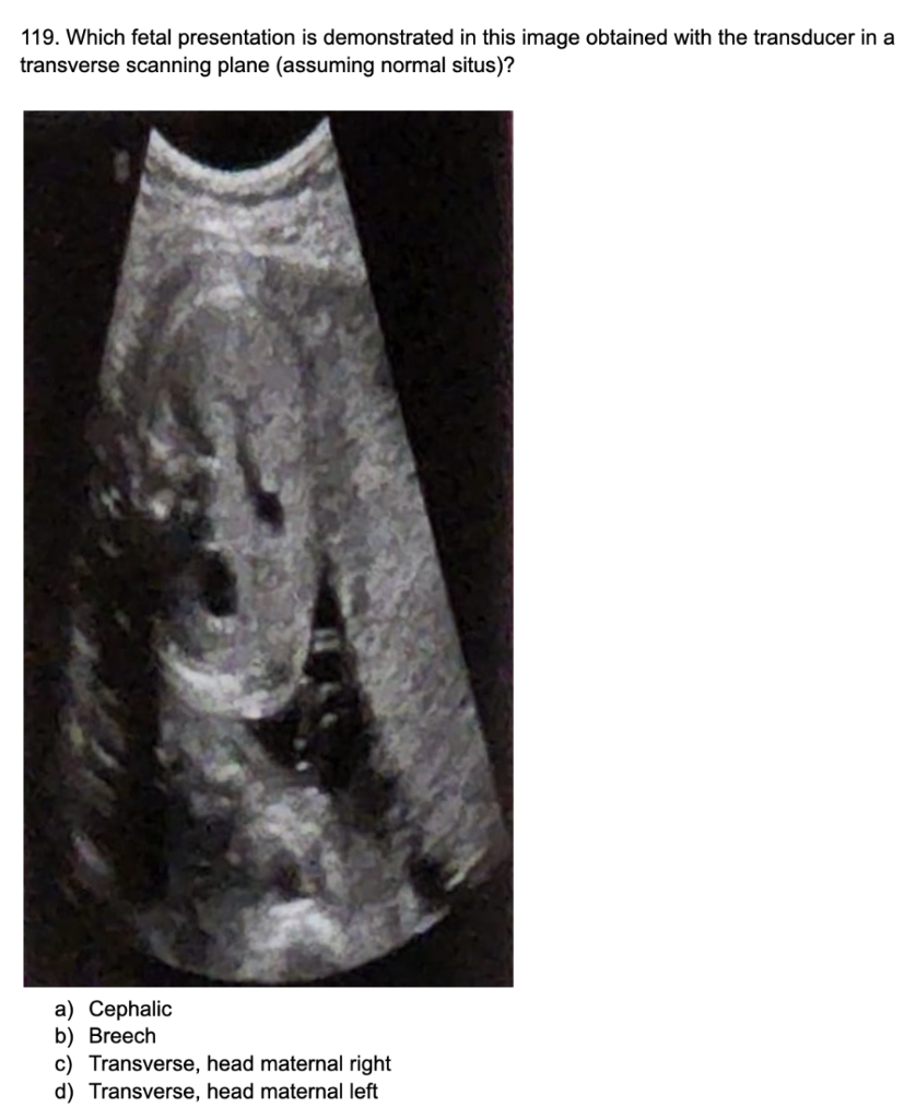 Solved 119. Which fetal presentation is demonstrated in this | Chegg.com