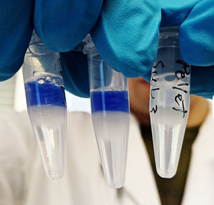 Solved I have a lysis reaction here using a Qiagen testing | Chegg.com