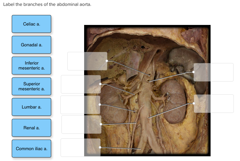 Solved Label the branches of the abdominal aorta. Celiac a. | Chegg.com