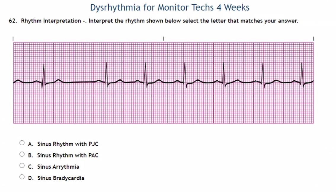 Solved Dysrhythmia for Monitor Techs 4 Weeks 62. Rhythm | Chegg.com