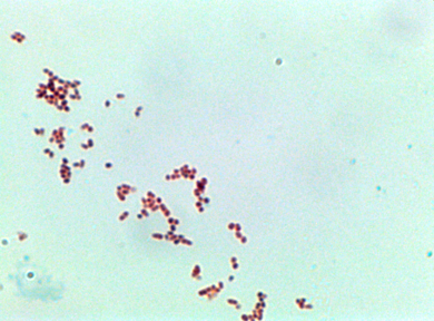 Solved Endospore stain (positive/negative)? | Chegg.com
