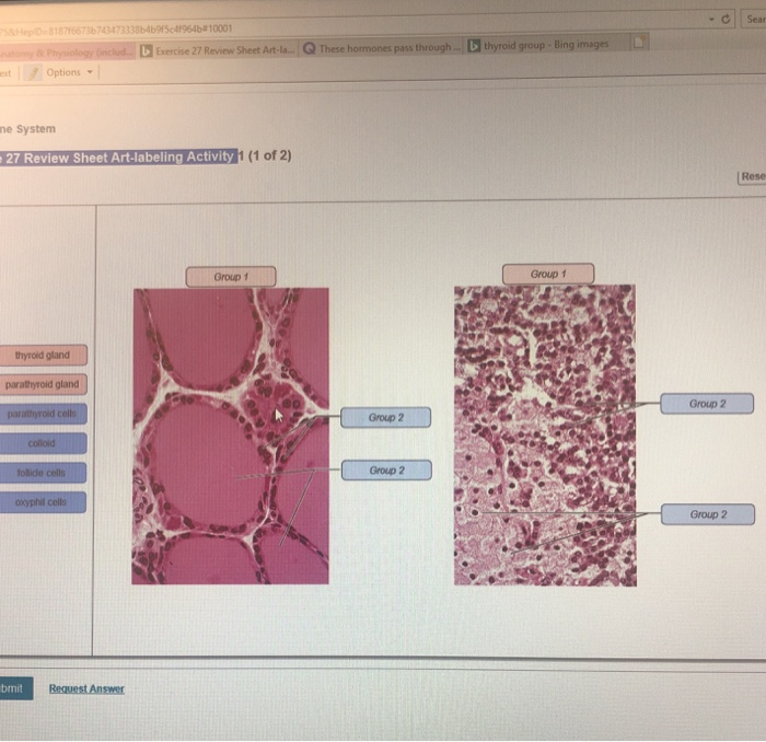 Solved Sear 818716673674347333064b9f5c41964b 1000 Exercise | Chegg.com