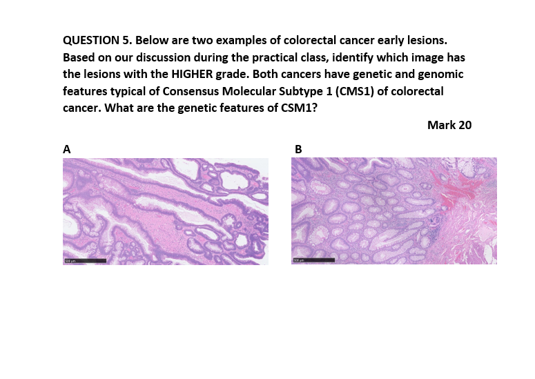 Solved QUESTION 5. Below are two examples of colorectal | Chegg.com