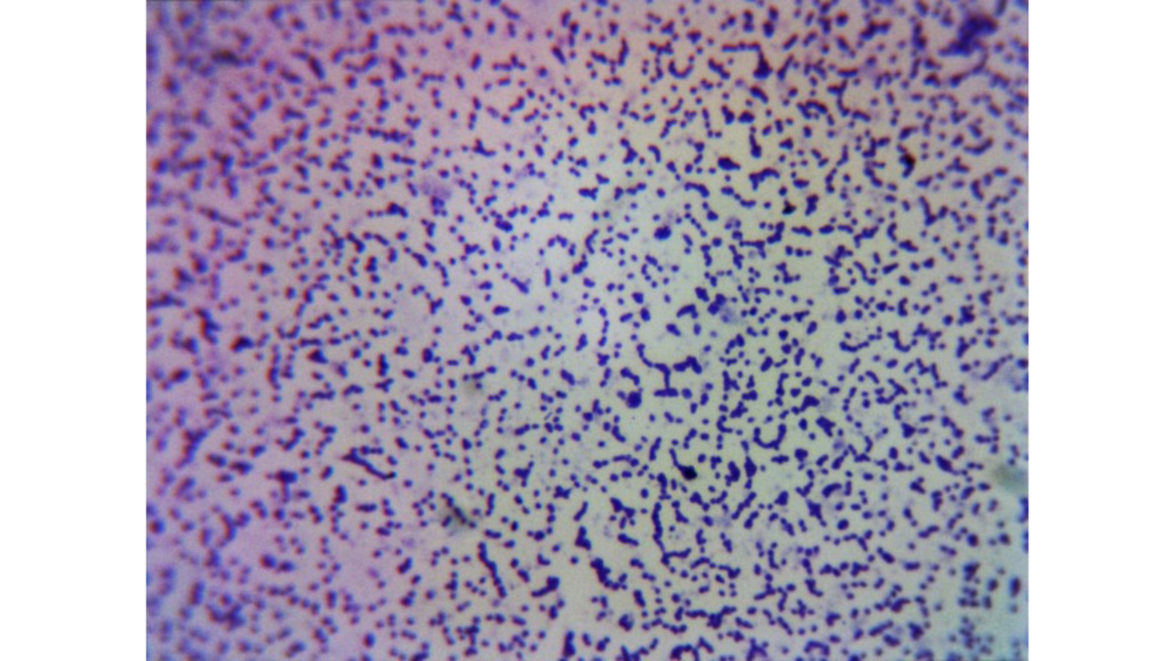 Solved Using the field of view calculated in Exercise 1 ﻿for | Chegg.com