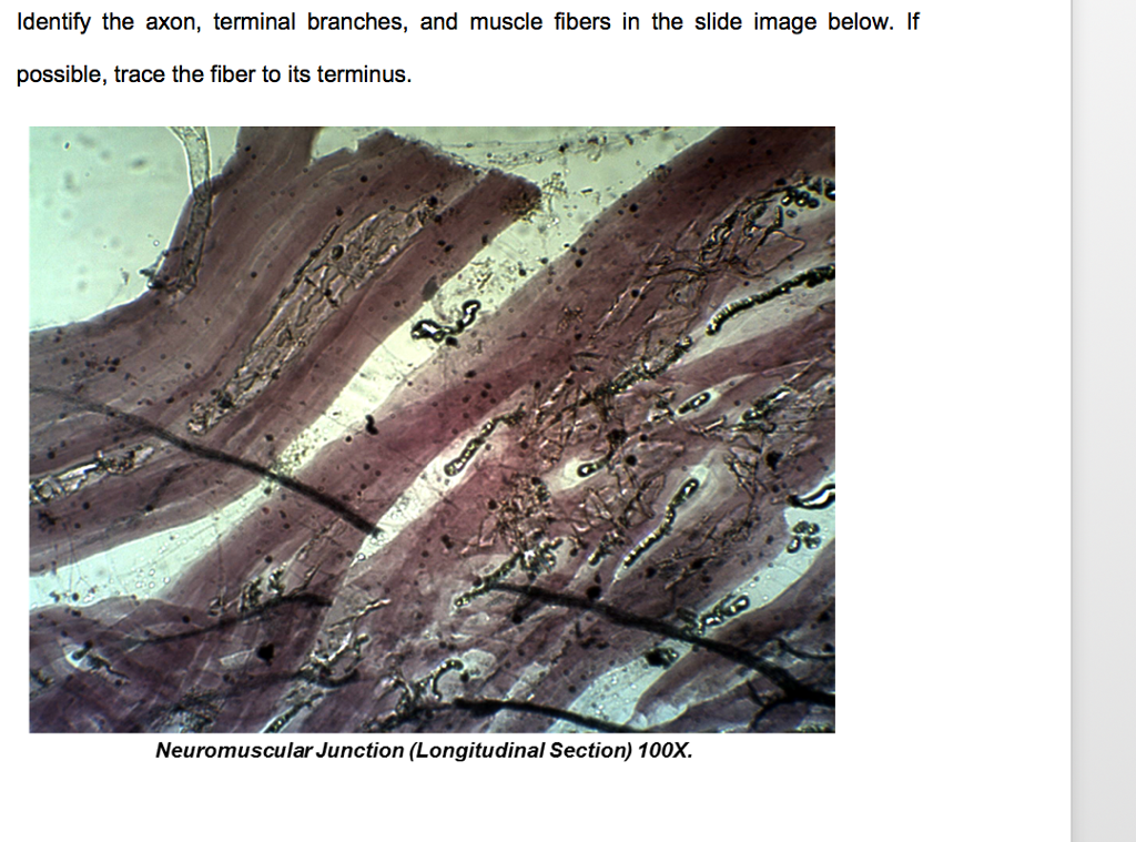 Solved ldentify the axon, terminal branches, and muscle | Chegg.com Solved ldentify the axon, terminal branches, and muscle | Chegg.com