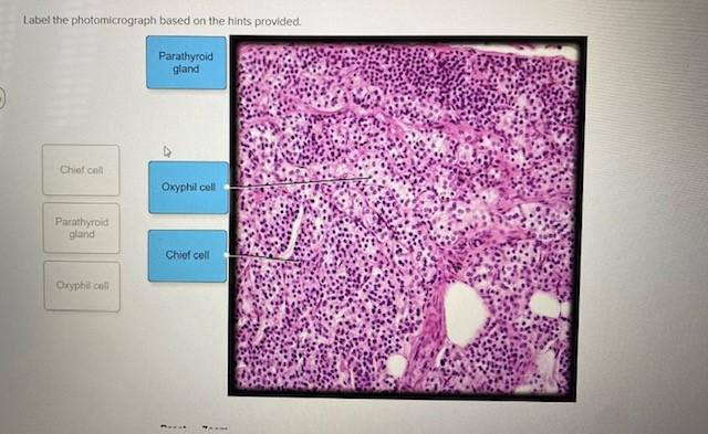 Solved Label the photomicrograph based on the hints | Chegg.com
