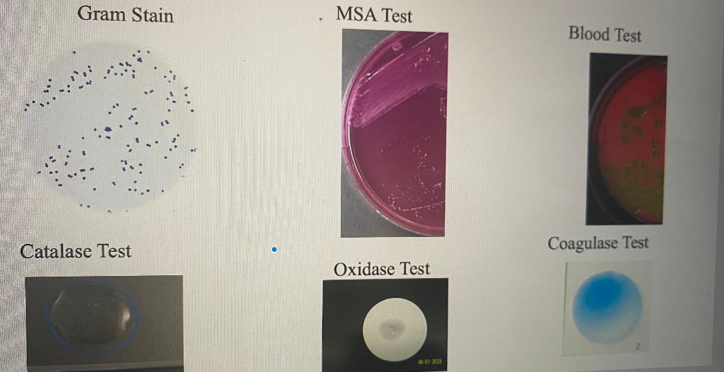 Solved Gram Stain MSA Test Blood Test Catalase Test | Chegg.com