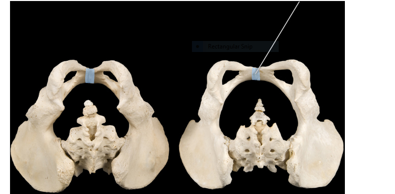 Solved Red The highlighted bone and the hip bone form what | Chegg.com