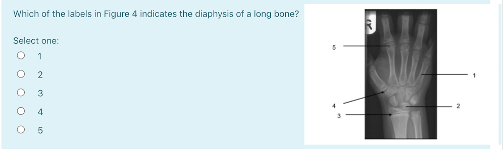 Solved Which of the labels in Figure 4 indicates the | Chegg.com