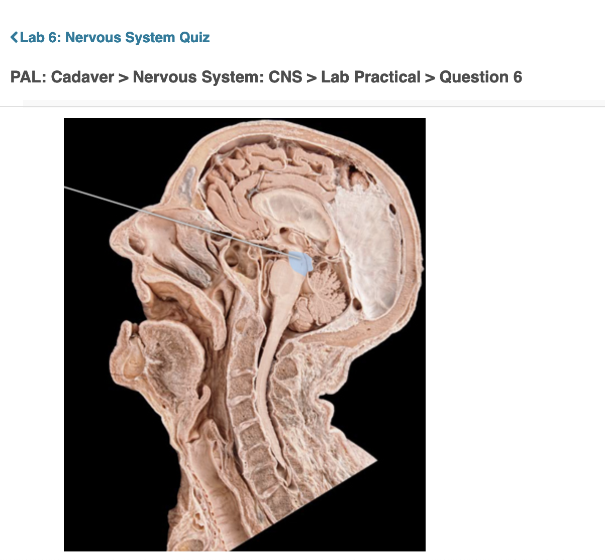 Solved Nervous System Cns Lab Practical Question 6 