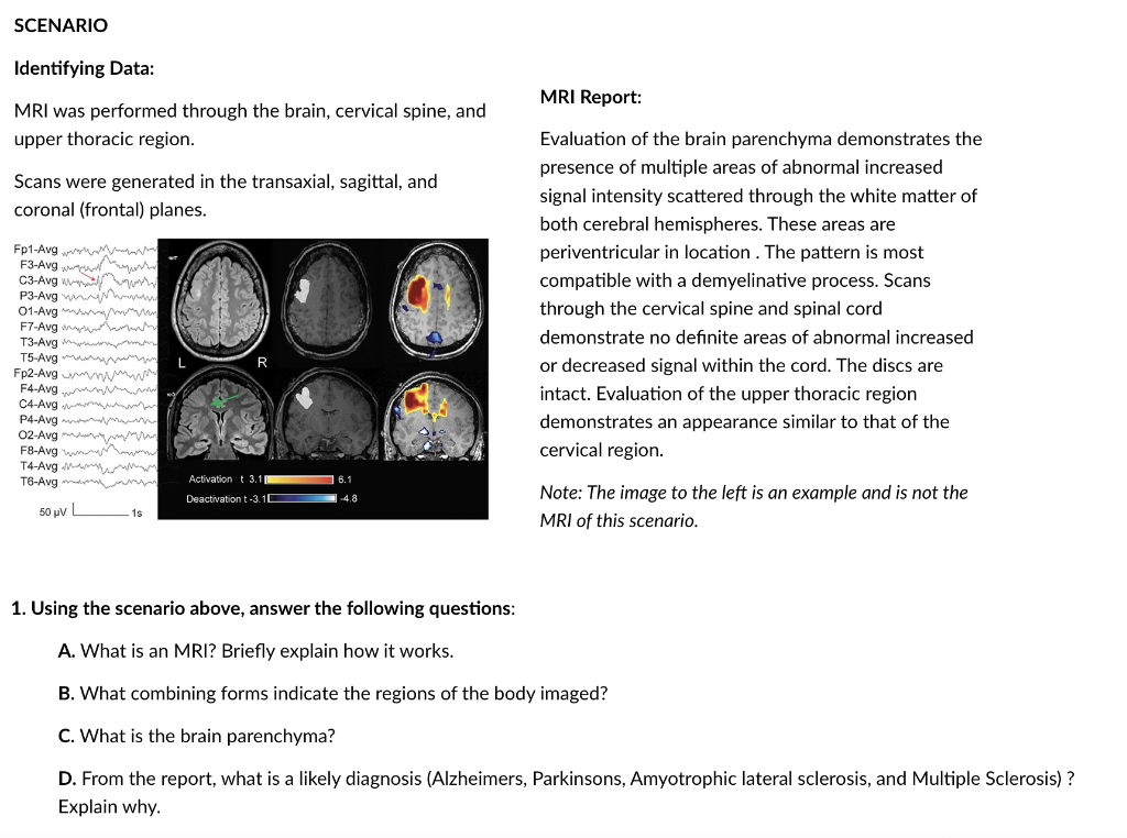Solved SCENARIO Identifying Data: MRI was performed through | Chegg.com