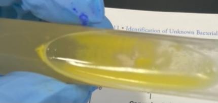 Solved I have this unknown bacteria. I have done a TSA slant | Chegg.com