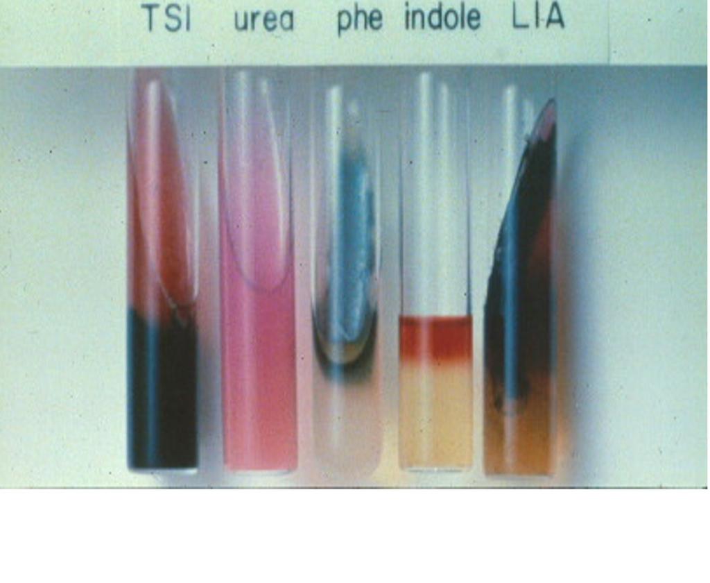 Solved TSI urea phe indole LIA | Chegg.com