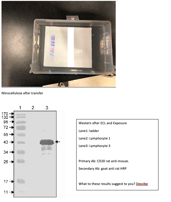 Solved Nitrocellulose after transfer Western after ECL and | Chegg.com
