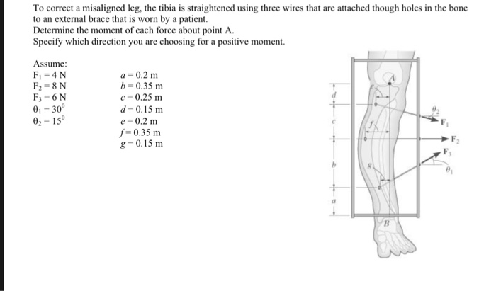 Solved To correct a misaligned leg, the tibia is | Chegg.com