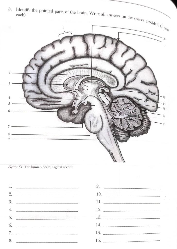 Solved 2. Identify the superlicial parts of the brain and | Chegg.com