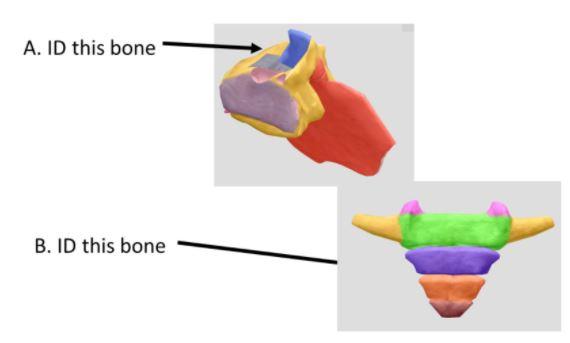Solved A. ID this bone B. ID this bone | Chegg.com