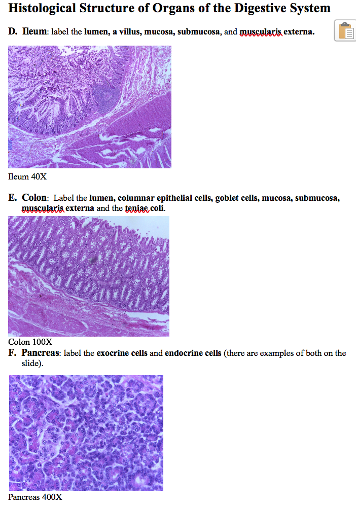 Ileum Slide Labeled