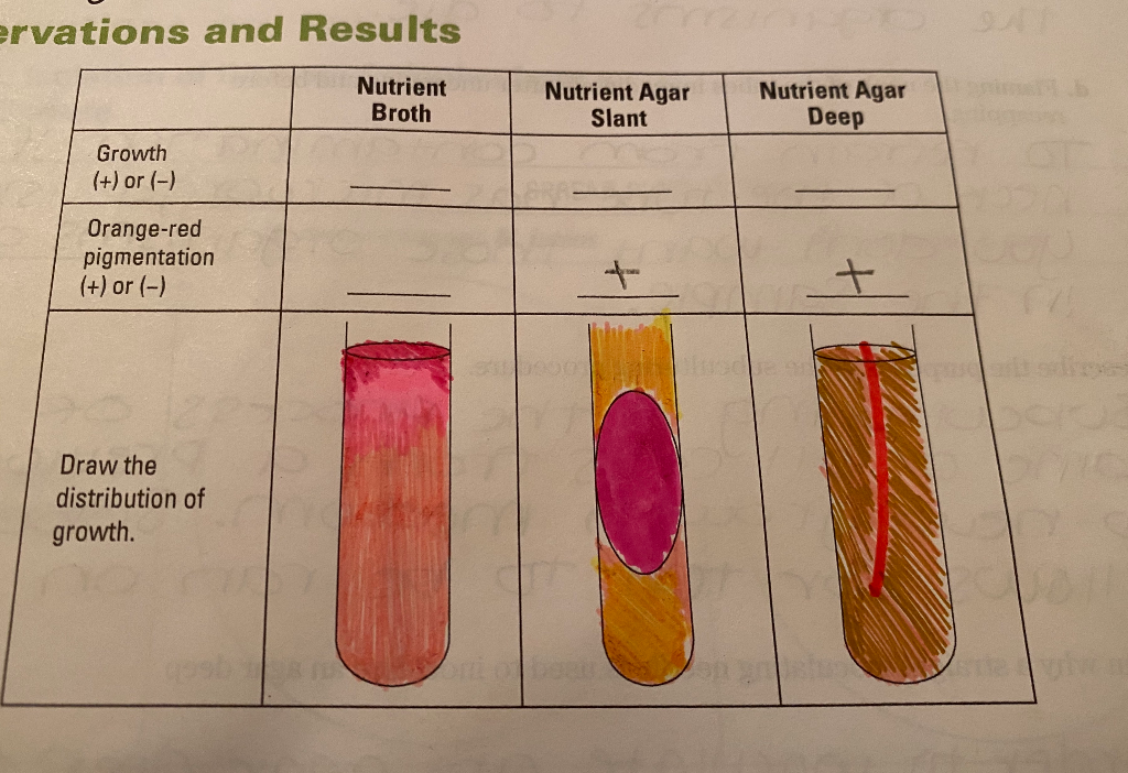 ervations and Results Nutrient Broth Nutrient Agar | Chegg.com