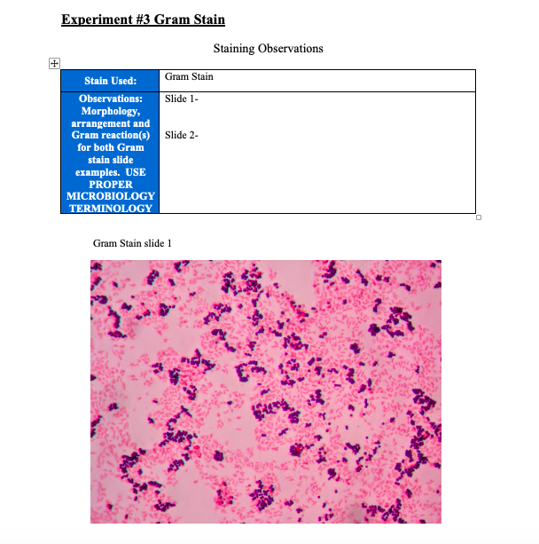 Solved Experiment #1 Simple Stain Using the photos provided, | Chegg.com