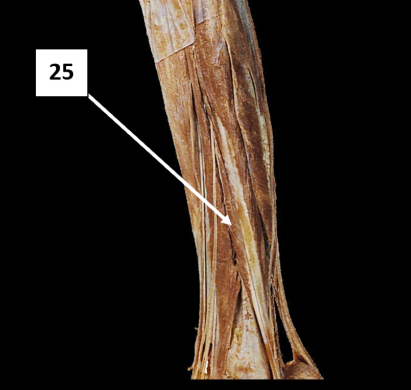 Solved Identify the pinned structure. Extensor Digitorum | Chegg.com