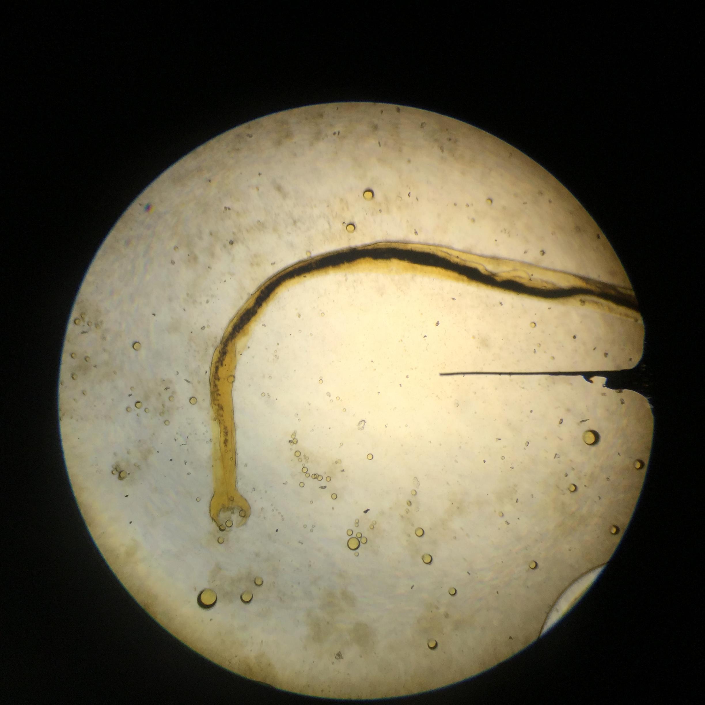 Uncinaria Stenocephala