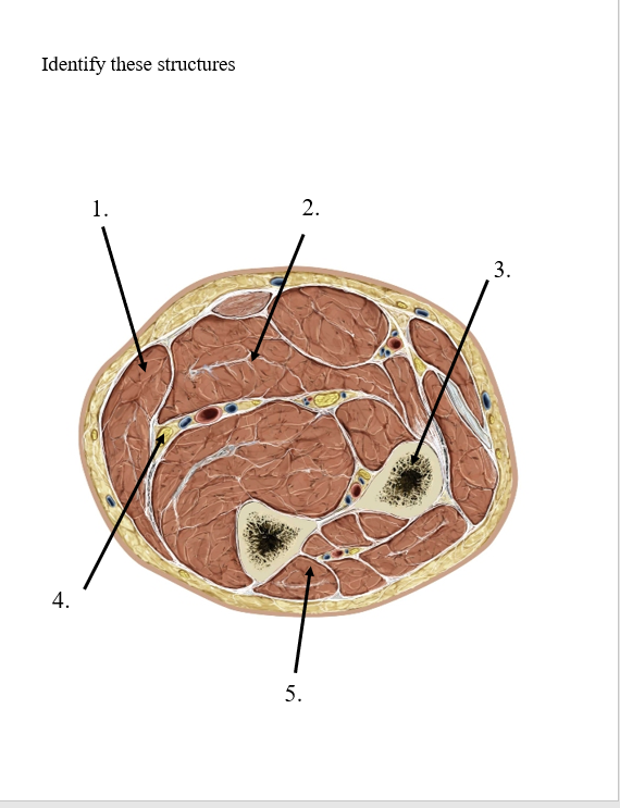 Solved Identify these structures Identify these structures | Chegg.com