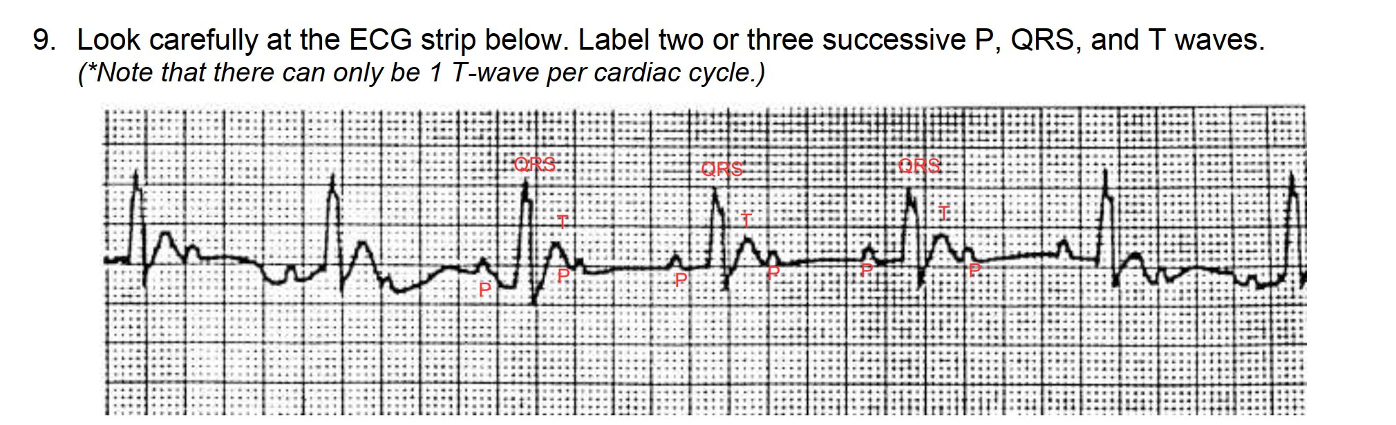 Solved 11. Measure the QRS interval from #9 and calculate | Chegg.com