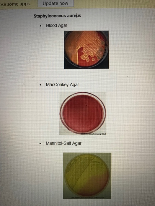 Solved Observe the following organisms growing on blood | Chegg.com
