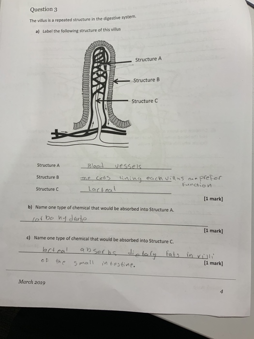 Solved Question 3 The Villus Is A Repeated Structure In The 