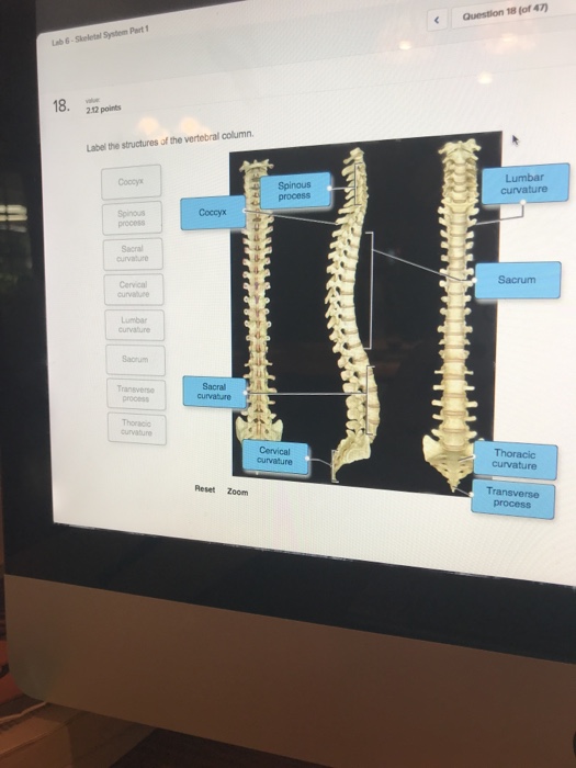 Solved Question 18 (of 47 ab 6-Skeletal System Part 212 | Chegg.com