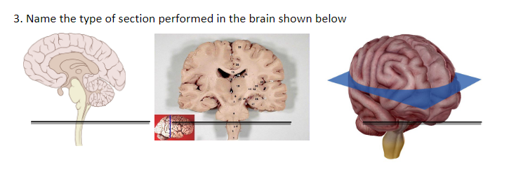 Solved 3. Name the type of section performed in the brain | Chegg.com