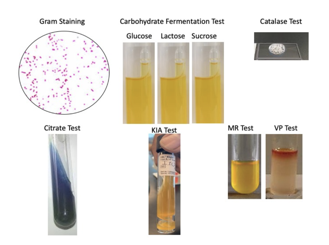 Solved The unknown bacteria are Gram-negative rod, postive | Chegg.com