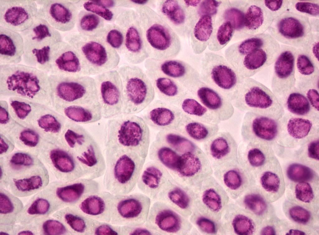 Solved There Are Five Pictures Of Bean Roots How Many Cells Chegg