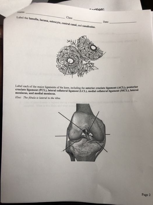 Solved tion: Class: lacuna, osteocyte, central canal, and | Chegg.com