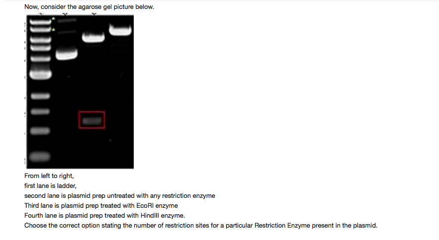 Solved Plasmid DNA can exist in three conformations, | Chegg.com