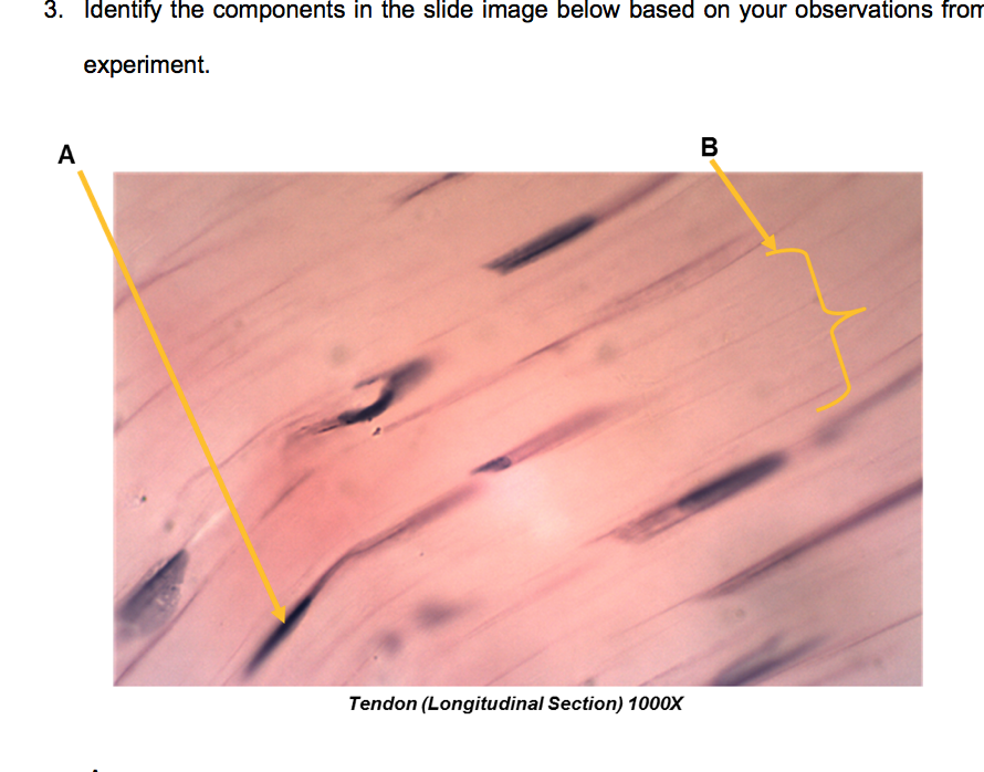Solved 3. Identify the components in the slide image below | Chegg.com