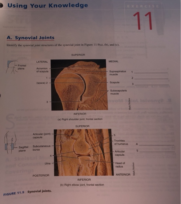 Solved Using Your Knowledge A. Synovial Joints Identify the | Chegg.com