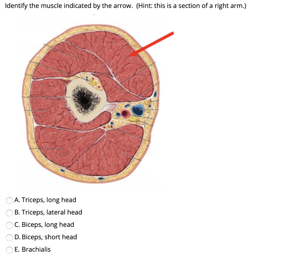 Solved Identify the muscle indicated by the arrow. (Hint: | Chegg.com