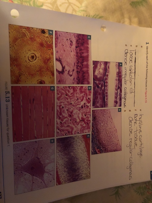 Solved 1 Identify each of the following tissues in Figure | Chegg.com