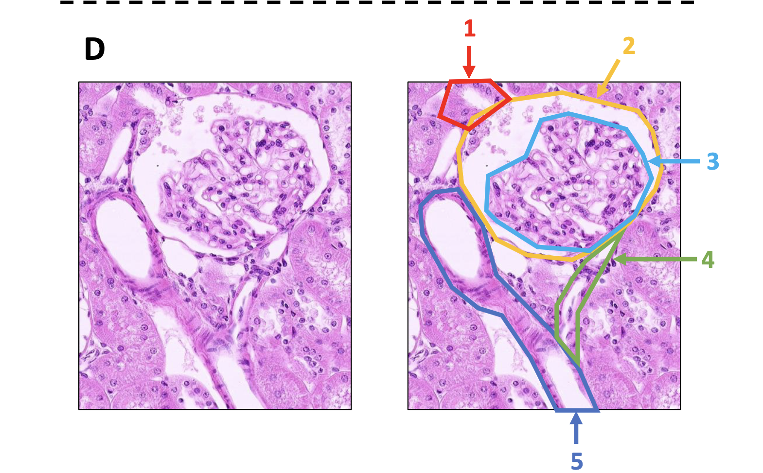 Solved 00 5 4 3 D 2 1 I I | | | | I | | I | I | | I I T | Chegg.com