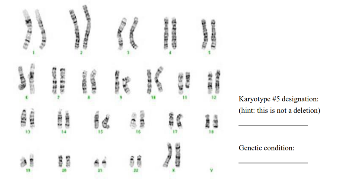 Deletion Karyotype